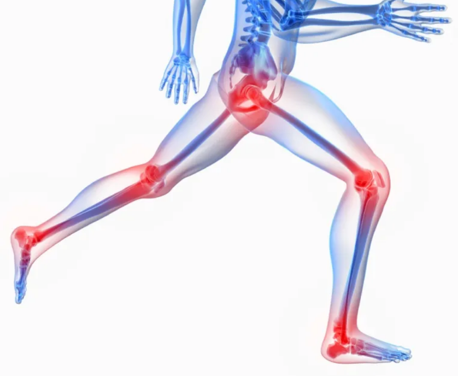 The 6 Most Common Running Injuries and How to Prevent Them